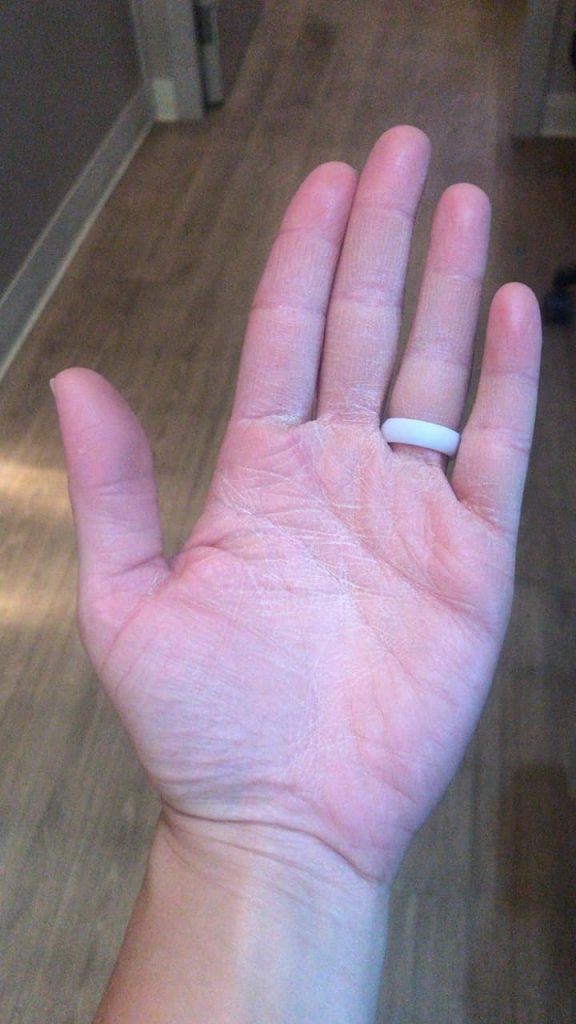 Understanding Drysol: A Comprehensive Guide for Hyperhidrosis ...